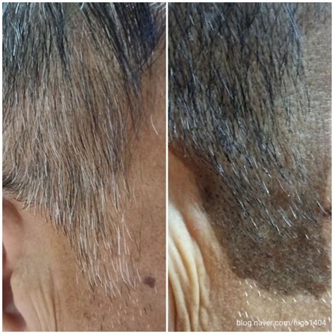 흰머리 셀프 염색약 새치 염색 주기 하는방법 네이버 블로그