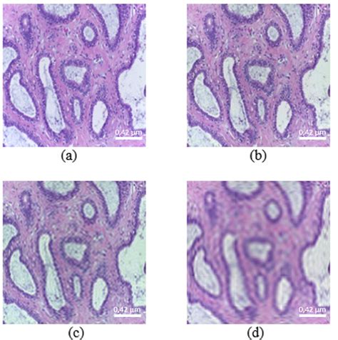Images From The Histopathological Dataset Scale Bar 042μm A Download Scientific Diagram