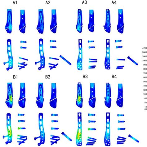 Von Mises Stress Vms Distribution Varies Concerning Different Download Scientific Diagram