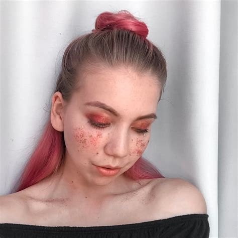 91000 Psoriasis Face Pictures