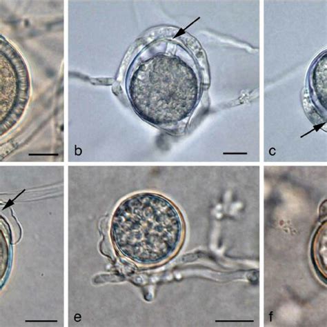 Sporangia Of Phytopythium Species A P Sindhum Four Stages Of Download Scientific Diagram