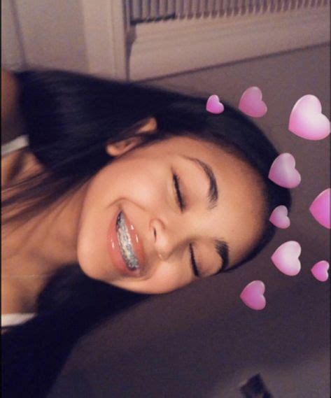 12 Baddies With Bracefaces Ideas Brace Face Cute Braces Braces Girls