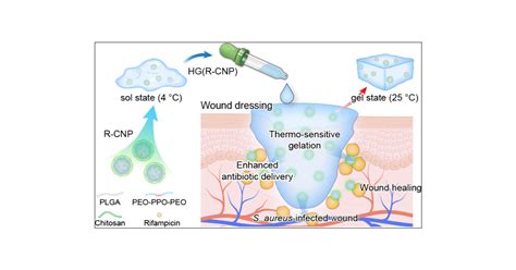 Biomedical Engineering On Smart Polymeric Nanoparticlehydrogel Platforms For Efficient