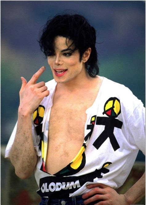 Vitiligo Michael Jackson Artofit