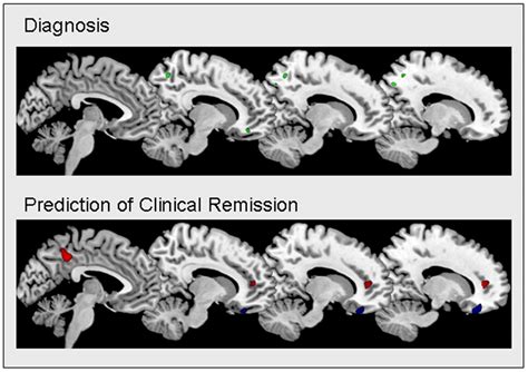 Sagittal Cross Sectional View Of Regions Pertinent For Diagnosis And