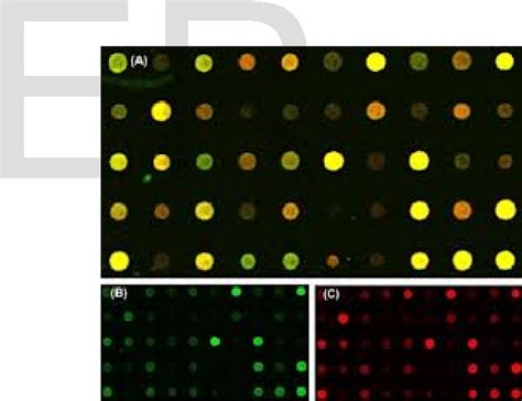 Figure 3 From Comparison Of Clustering Techniques For Microarray Image Segmentation Semantic