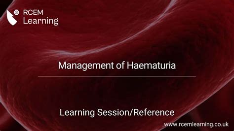 Reference Learningsession Rcemlearning