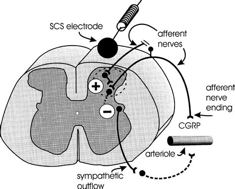 Physiology Of Spinal Cord Stimulation Review And Update Neuromodulation