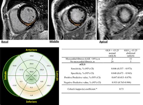 Cmr Lge Basal Mid Apical Slices Upper Section And 3dste Segmental