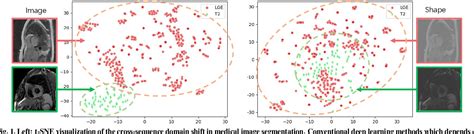 Figure 1 From Bayeseg Bayesian Modeling For Medical Image Segmentation