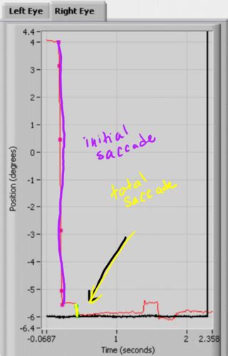 4 Ocular Motility Testing Flashcards Quizlet