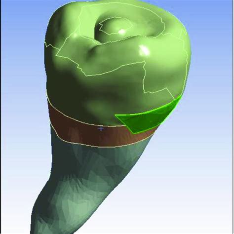 Meshed Finite Element Model Of Premolar Tooth Download Scientific Diagram