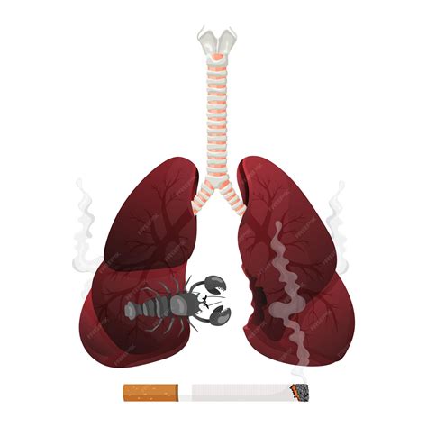 폐 흡연자 폐암 질병의 그림 금연 벡터 일러스트 레이 션의 개념 프리미엄 벡터