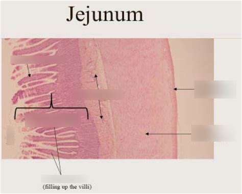 Jejunum Diagram Quizlet