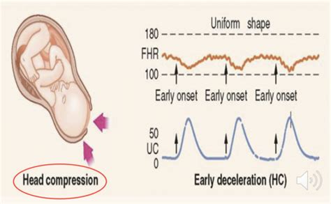 Module 2 Flashcards Quizlet Module 2 Flashcards Quizlet