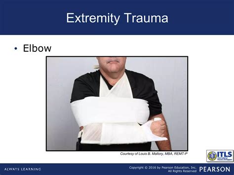 Chapter14 Extremity Trauma Ppt