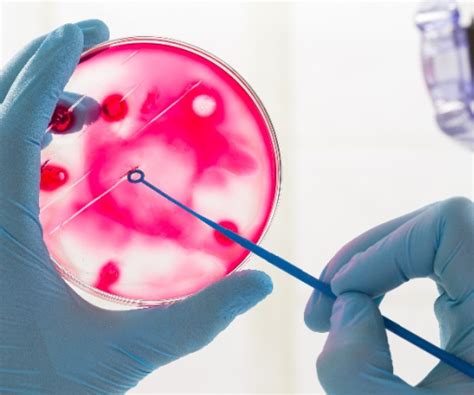 Testing For Harmful Bacteria And Reliable Testing Solutions Testaustralia