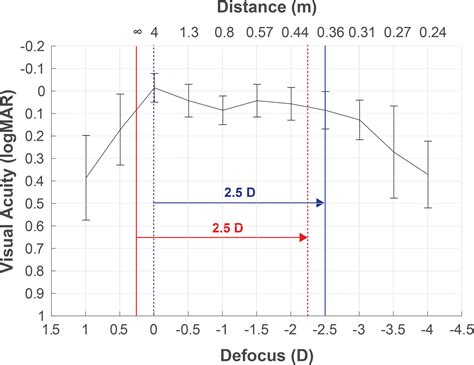 Refraction And Defocus Curves In Eyes With Monofocal And Multifocal Intraocular Lenses Journal