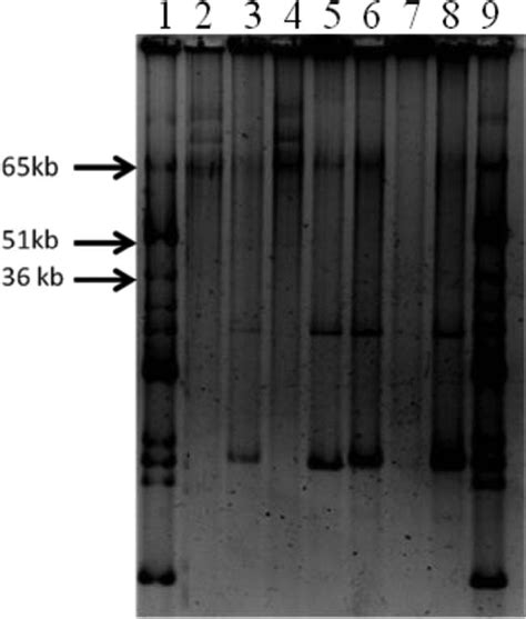 Plasmid Profiles Of Bacteriocinogenic Enterococci Lanes 1 And 9 Download Scientific Diagram