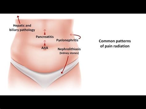 Free Video An Approach To Acute Abdominal Pain From Strong Medicine Class Central