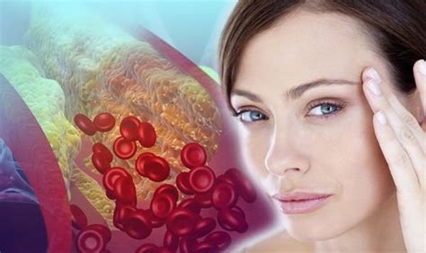 High Cholesterol Lumps Known As Xanthelasma Or A Ring Around Iris Are Signs To Spot Uk