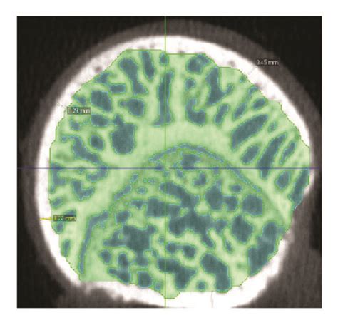 Micro CT Scanning Images A Representative Micro CT Image From The Download Scientific Diagram