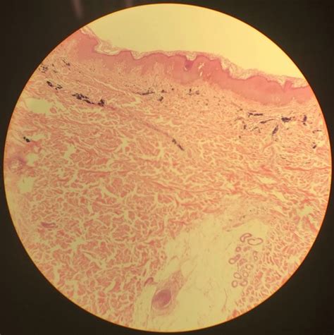 Lab 4 Integ System Joint Anat Articulations Radiology And Into To Powerlab Flashcards