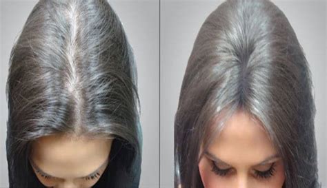 თმის ინტენსიური ცვენა ნატურალური ნარევით შევიჩერე რომელსაც დღეს თქვენც გაგაცნობთ