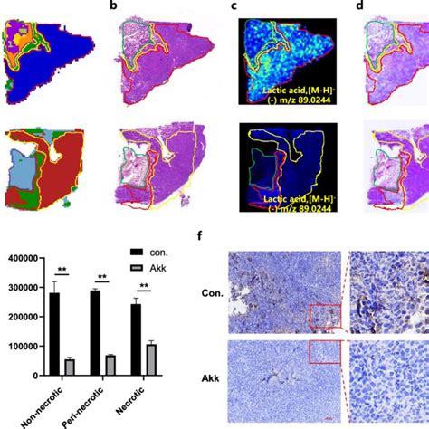 In Situ Visualization Of Crucial Metabolite And Metabolic Enzymes In Download Scientific