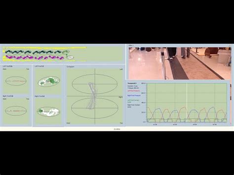 GAIT ANALYSIS