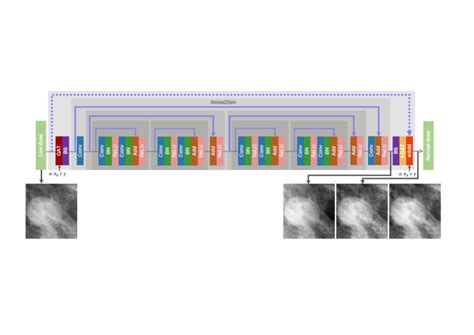 Convolutional Neural Network To Restore Low Dose Digital Breast