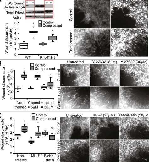 Actomyosin Contractility Is Not Necessary For Compression Induced Download Scientific Diagram