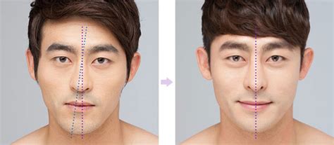 East Rose Dental Prestigious Dental Center In Hcmc