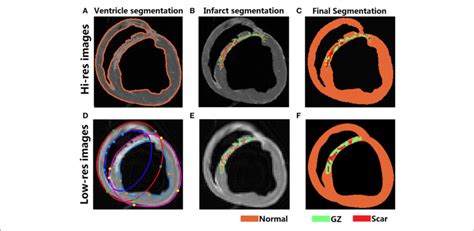 Segmentation Of Hi Res And Low Res Images Top Row Automatic