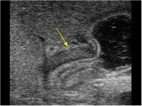 Pediatrics 91 Pediatric Abdomen And Retroperitoneum Case 911