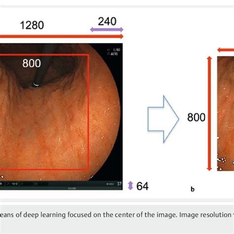 Pdf Deep Learning Analyzes Helicobacter Pylori Infection By Upper Gastrointestinal Endoscopy