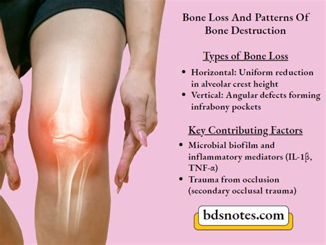 Patterns Of Bone Loss And Destruction In Periodontics Bds Notes
