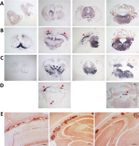 Prp Sc Distribution In Representative Brain Sections From Tgshp Xi Mice Download Scientific