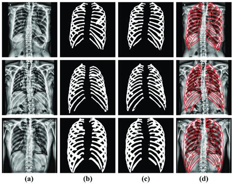 Segmentation Model Results A Original Images B Ground Truth Download Scientific Diagram