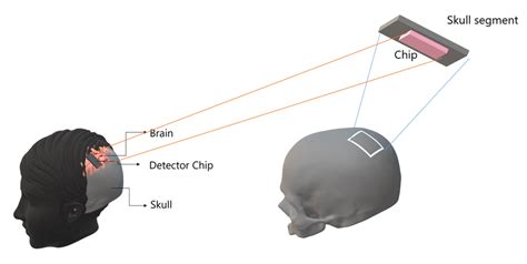A Detector Chip Can Be Installed On The Interior Surface Of The Skull Download Scientific