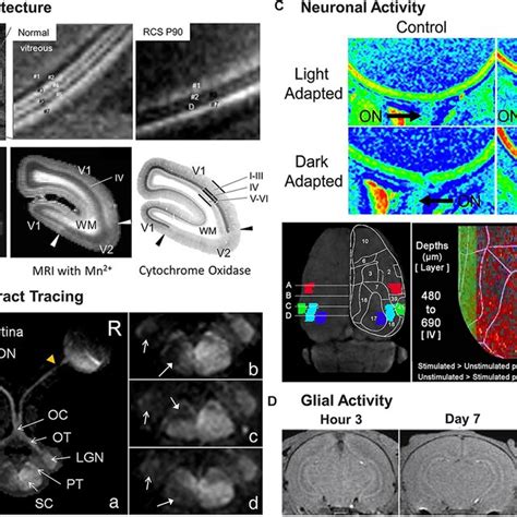 Comparisons Between Primate Ac And Rodent Visual Systems Bd Download Scientific Diagram