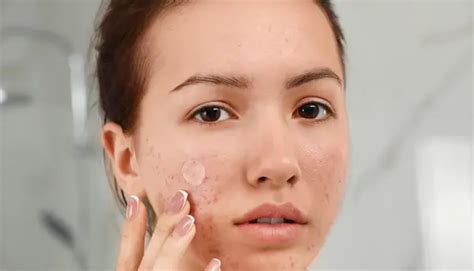 Apa Itu Modem Pengertian Fungsi Dan Jenisnya Feeds Liputan Com