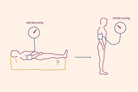 Kreislaufprobleme Bei Parkinson Ursachen And Alltagstipps