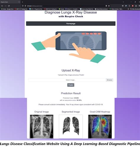 Build Deep Learning Solutions For Object Detection Image Classification And Cv By Ristian