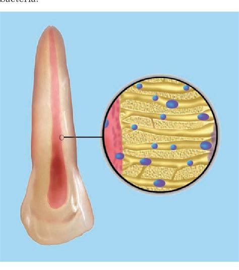 Chlorhexidine Gluconate 25 Mg Drug Implant Periochip Semantic Scholar