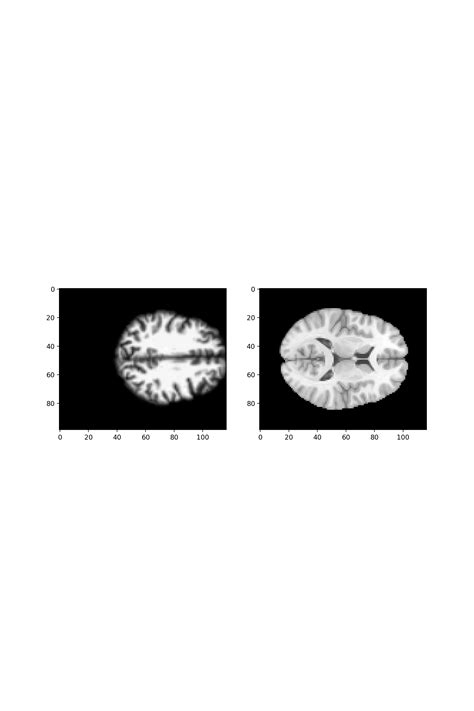 Affine Optimization Exercise — Functional Mri Methods