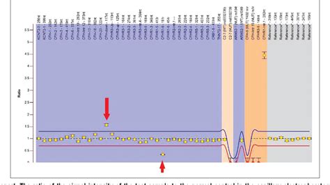 Pdf Atypical Hus Associated With Cfhcfhr 1 Hybrid Gene Semantic Scholar