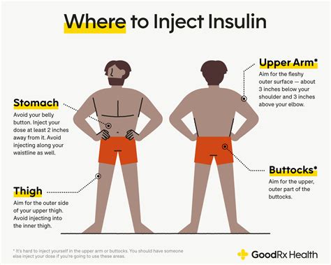 insulin injection sites map at gerard ortega blog