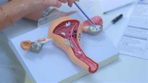 Gynecologist Explains Anatomy Of Female Reproductive System Stock Video