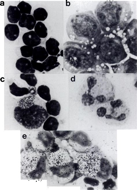 Figure 1 From Myeloid Differentiation Of Human Blood Mononuclear Cells